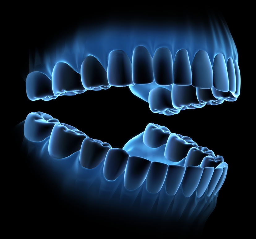 3D Digital Scanning in Sheffield - Ortho Unlimited