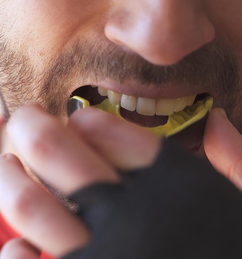 Lynx Sport Mouth Guards, Made in Sheffield - Ortho Unlimited