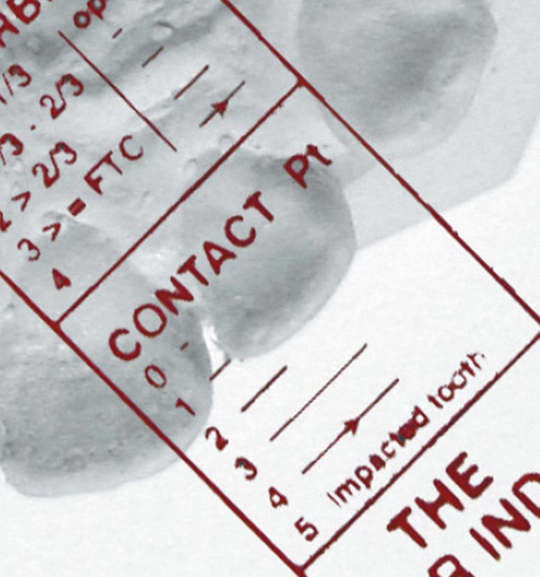 PAR Scoring Service in Sheffield - Ortho Unlimited